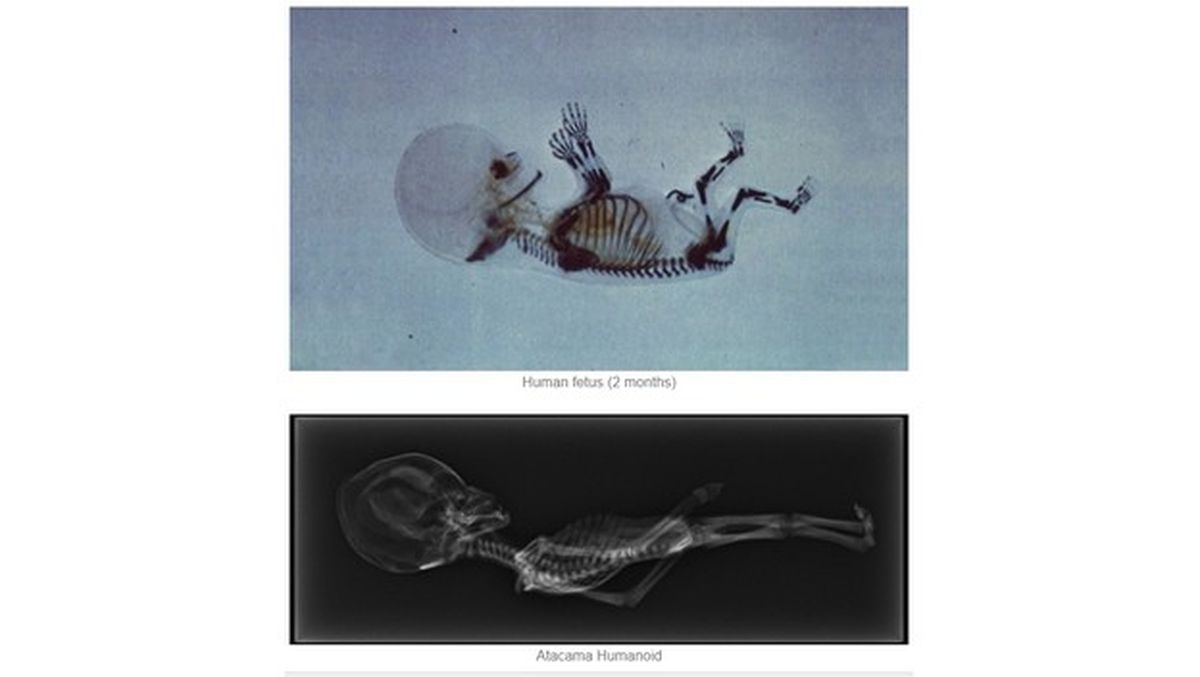 Descubren quién es el alien de Atacama, gracias al ADN