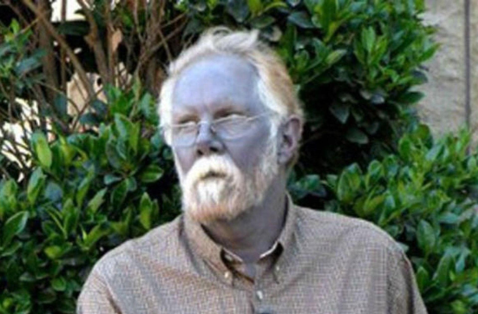 Por qué algunas personas tienen la piel azul