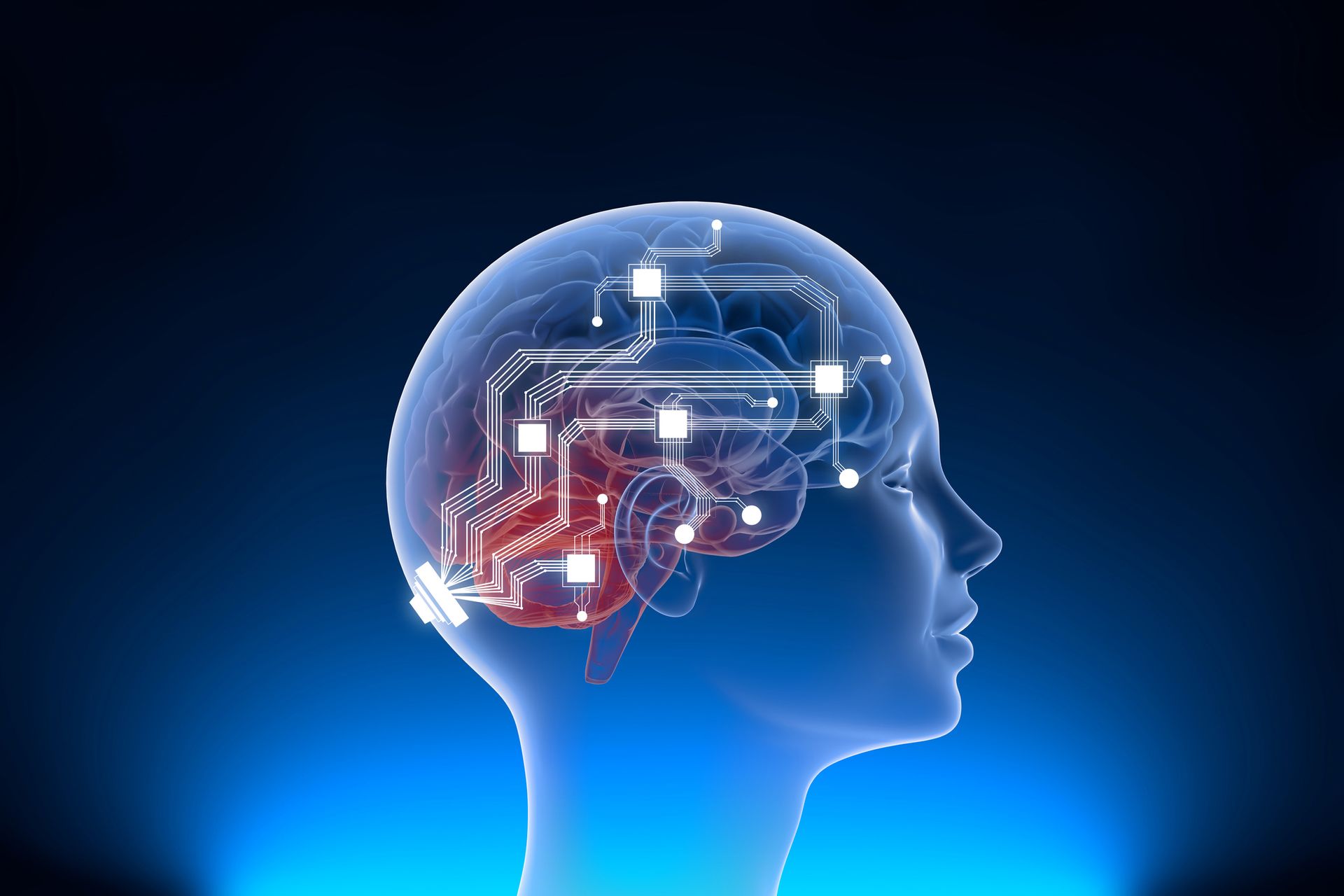 Elon Musk ha confirmado que ya se ha instalado el implante cerebral ...